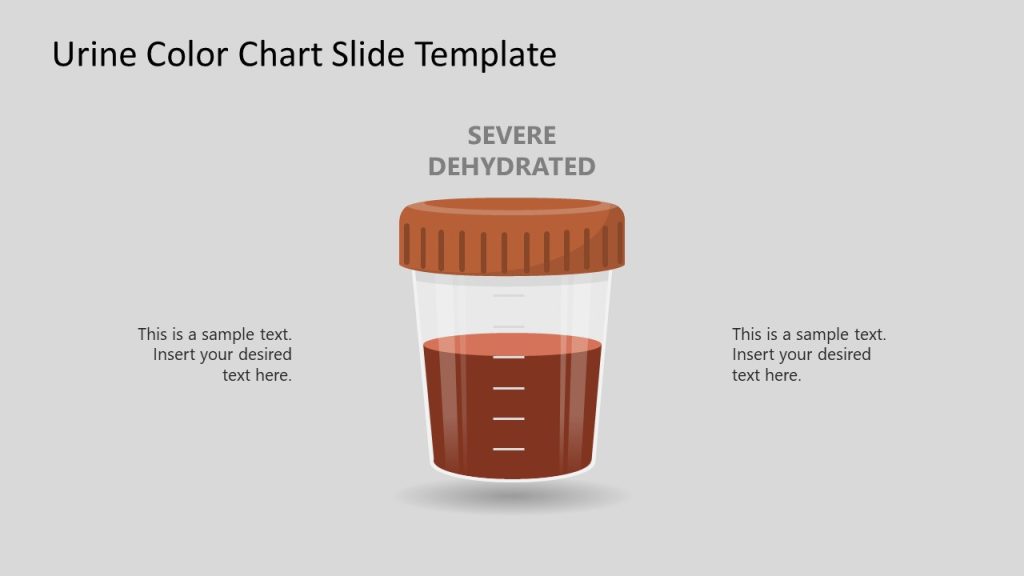 Urine Color Chart Presentation Template - SlideModel